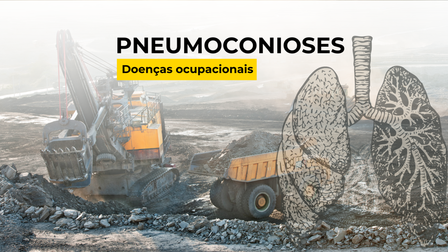 Pneumoconioses - MedConcursos